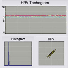 HRV